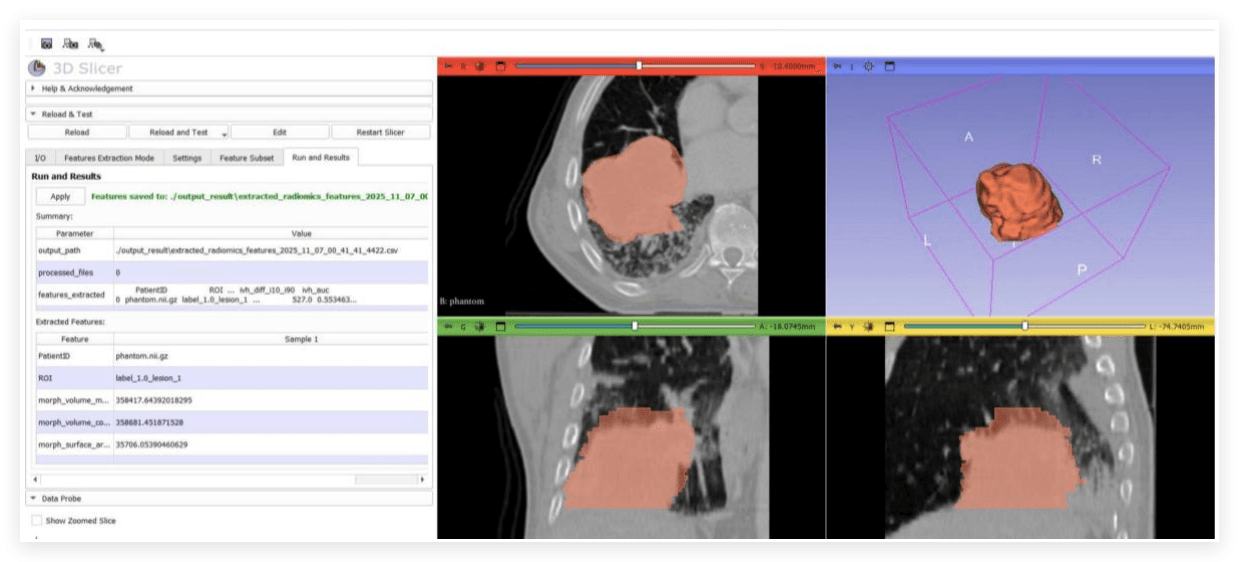 PySERA: Python-Based Standardized Extraction for Radiomics Analysis ...